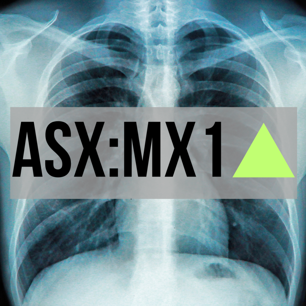 Micro-X [ASX:MX1] Secures $21 Million Contract Extension to Build Self ...